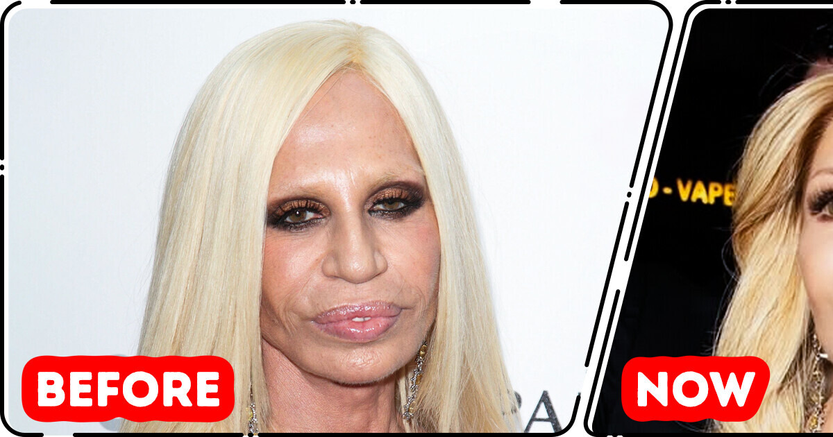 “This Is the Best She Has Looked in Decades!” New Look of Donatella ...