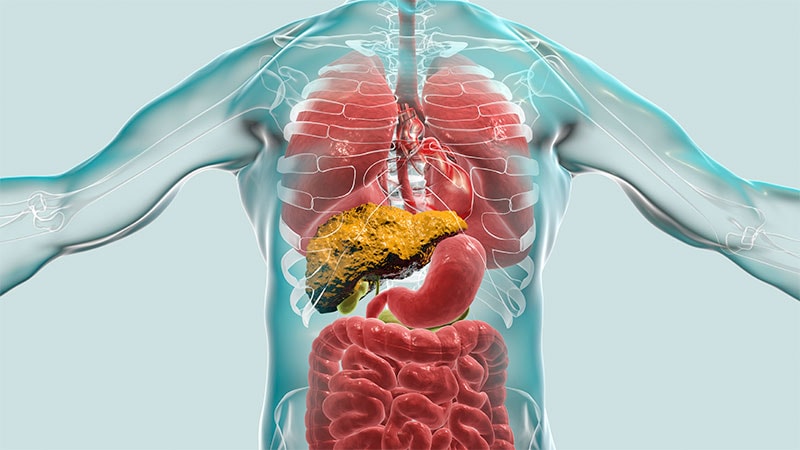 Preemptive TIPS Promising for Fundal Variceal Bleeding – #purplerelativity